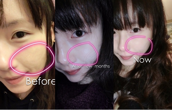 Food Suplements Singapore: Kinohimitsu BB Drink Bird's Nest 10's x 2 Packs